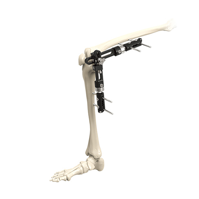 China orthopedic knee joint external fixator for knee joint bone ...