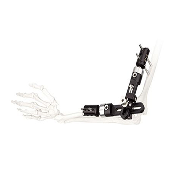 China Orthofix Elbow Joint External Fixators for Orthopedic Fixation ...