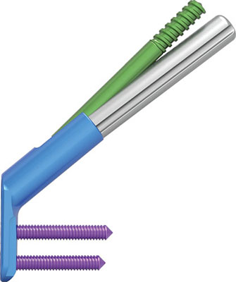 New Product FNS System for Femur Neck Fracture Interlocking Nails from ...