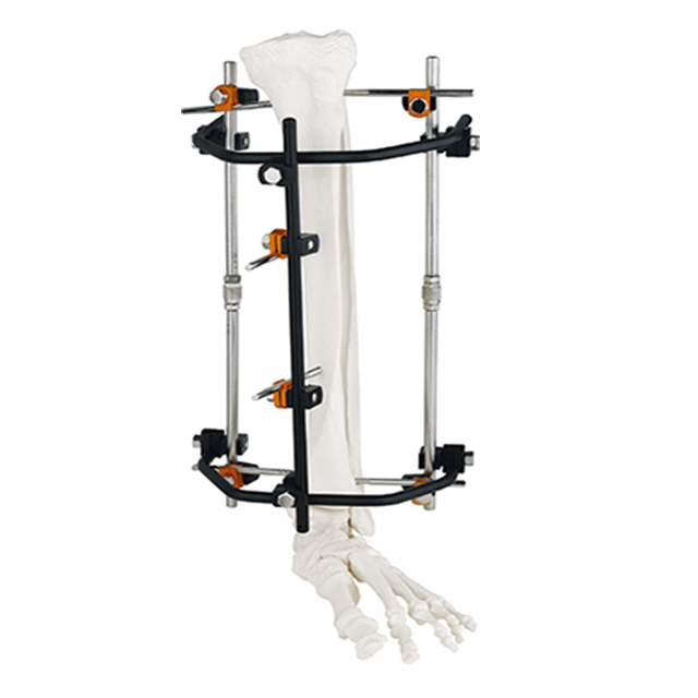 AO Design Combinational Half Ring Type External Fixators for Tibia ...