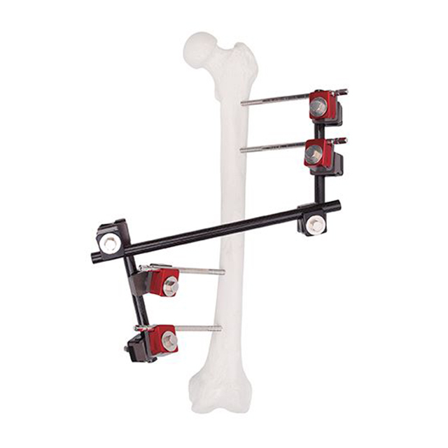 China Universal Combinational External Fixators manufacturers ...